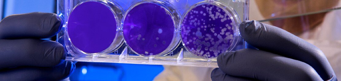 AI Healthcare & Infection Control